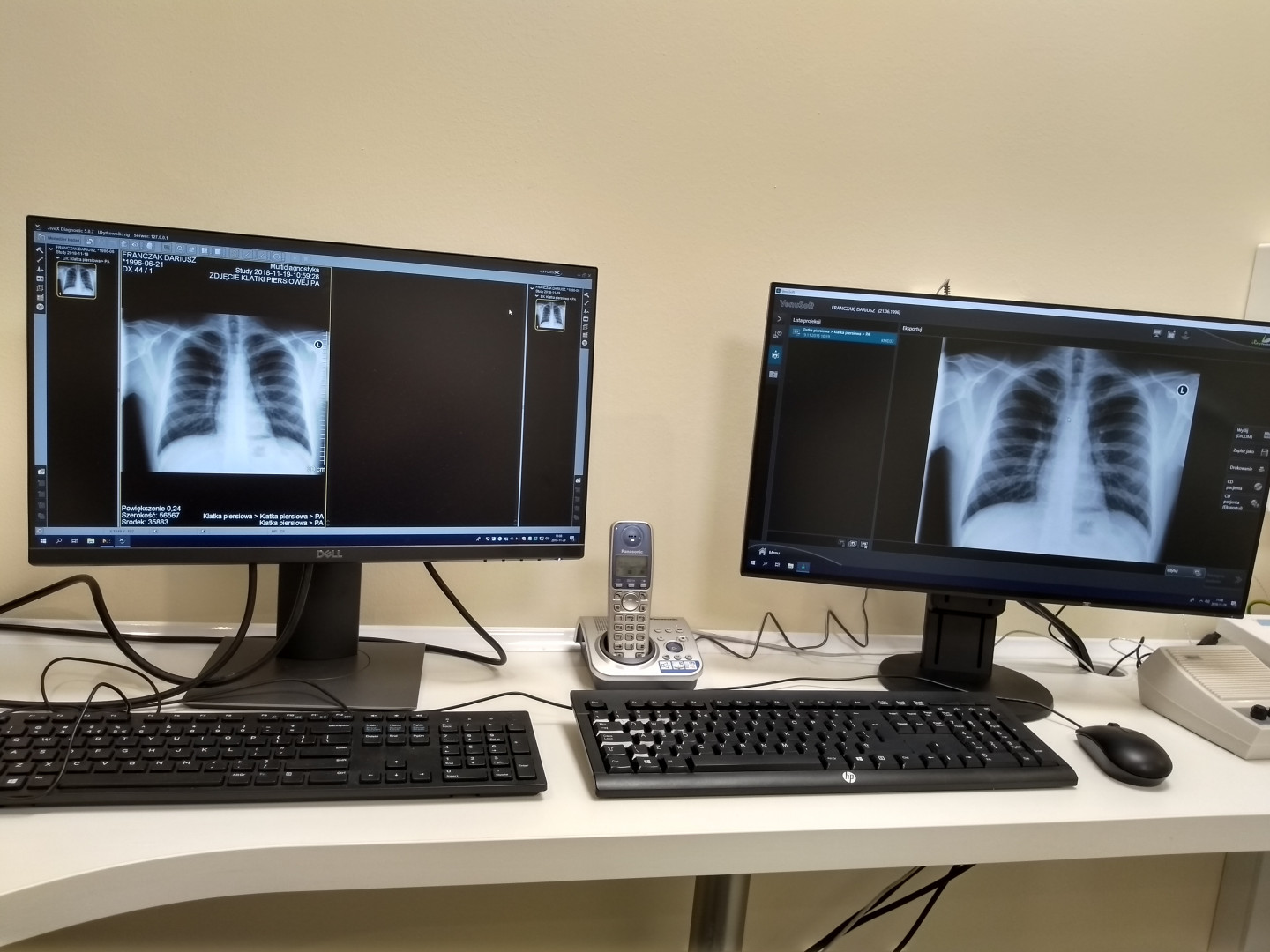 Rentgen RTG Kraków Pracownia Cyfrowej Diagnostyki Obrazowej