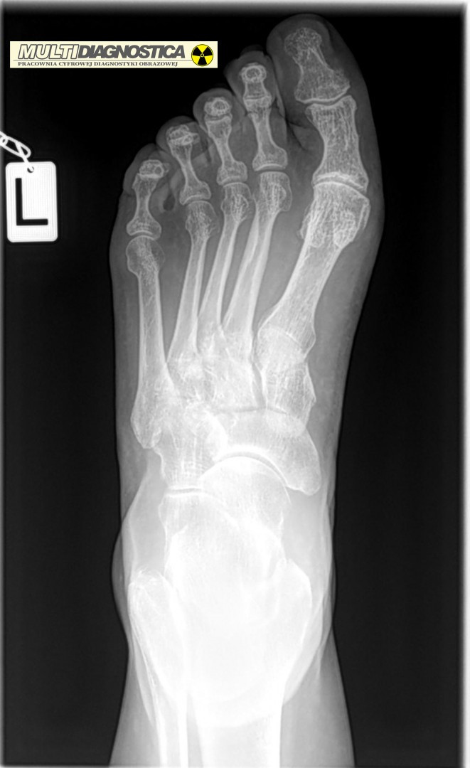 Rentgen RTG Kraków Pracownia Cyfrowej Diagnostyki Obrazowej