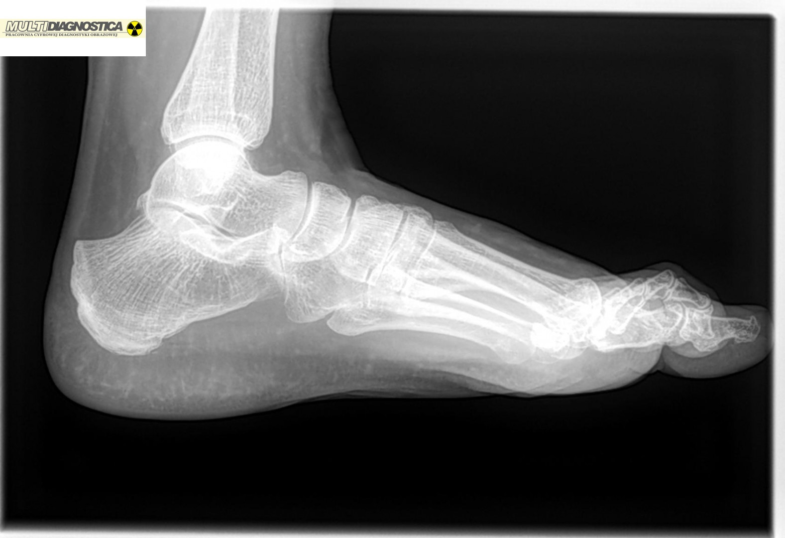 Rentgen RTG Kraków Pracownia Cyfrowej Diagnostyki Obrazowej