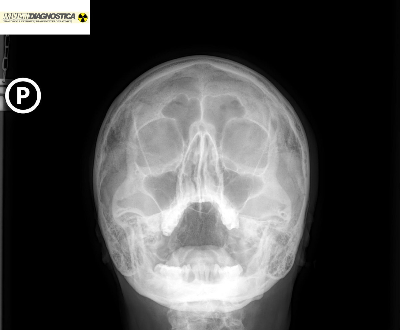 Rentgen RTG Kraków Pracownia Cyfrowej Diagnostyki Obrazowej