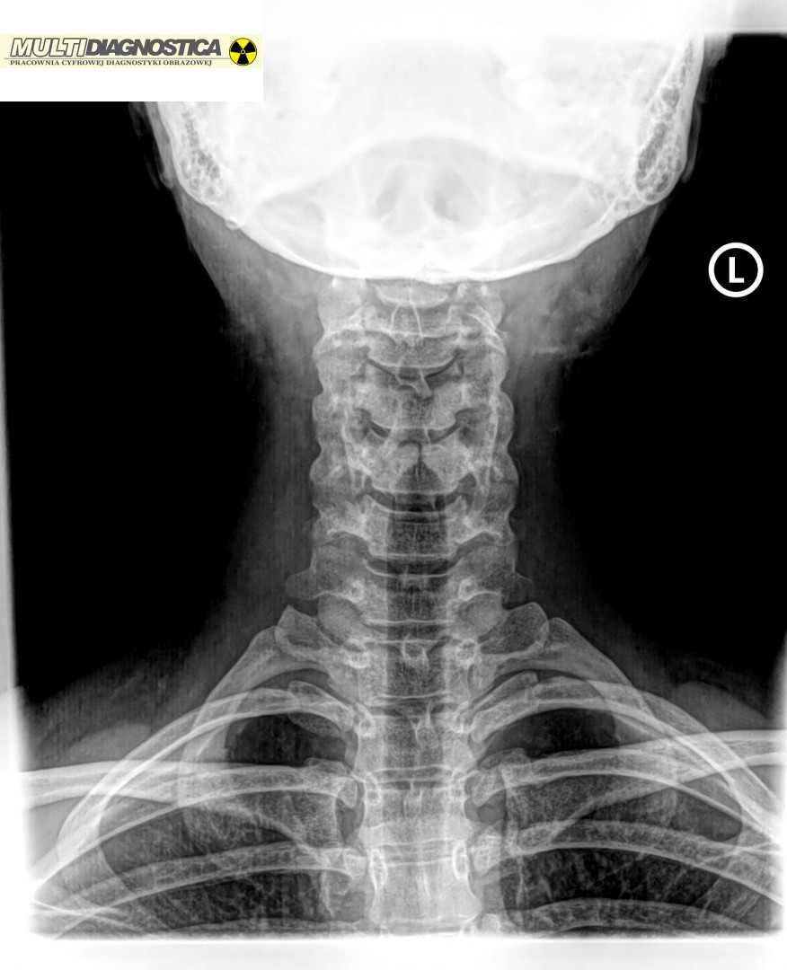 Rentgen RTG Kraków Pracownia Cyfrowej Diagnostyki Obrazowej