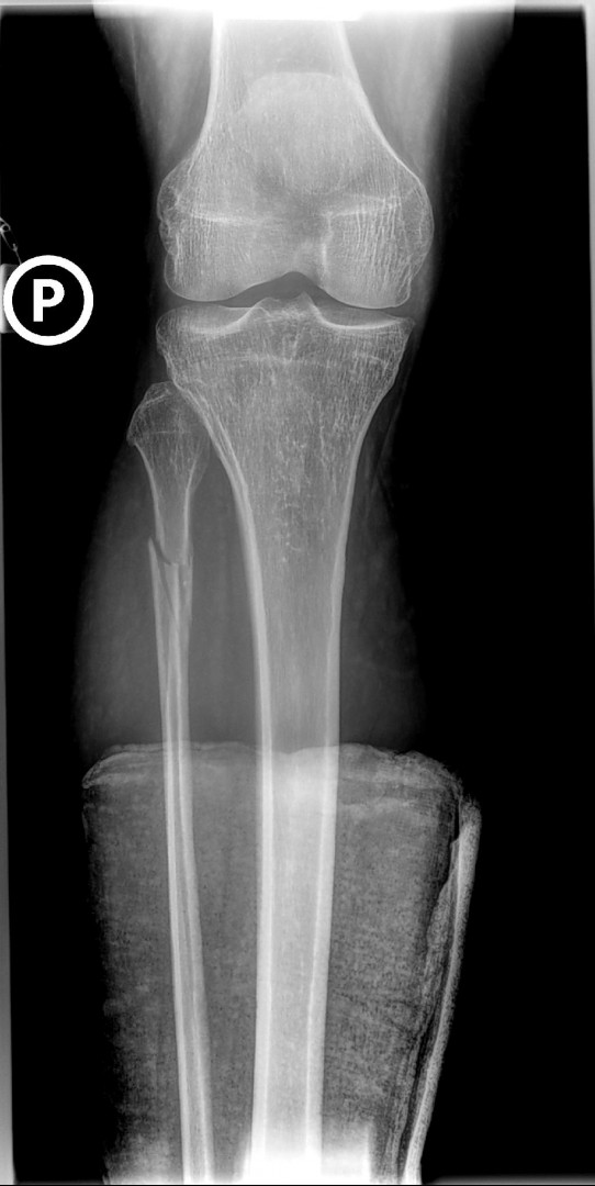 Rentgen RTG Kraków Pracownia Cyfrowej Diagnostyki Obrazowej