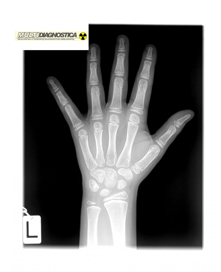 Rentgen RTG Kraków Pracownia Cyfrowej Diagnostyki Obrazowej