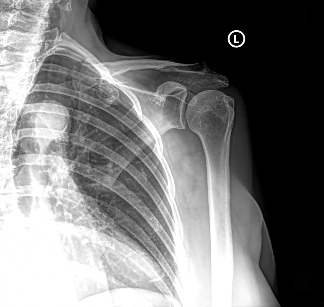Rentgen RTG Kraków Pracownia Cyfrowej Diagnostyki Obrazowej