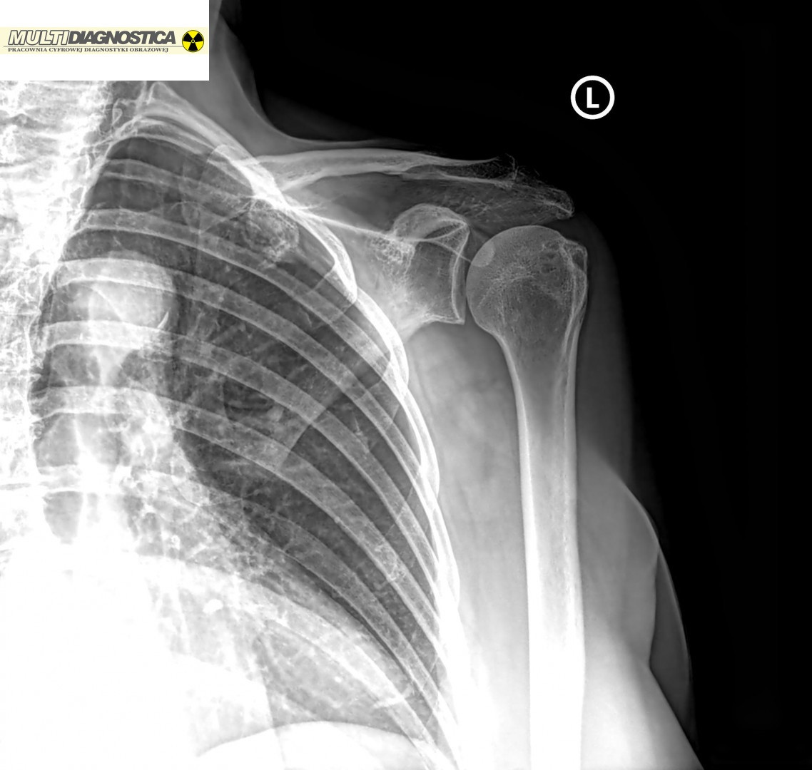 Rentgen RTG Kraków Pracownia Cyfrowej Diagnostyki Obrazowej