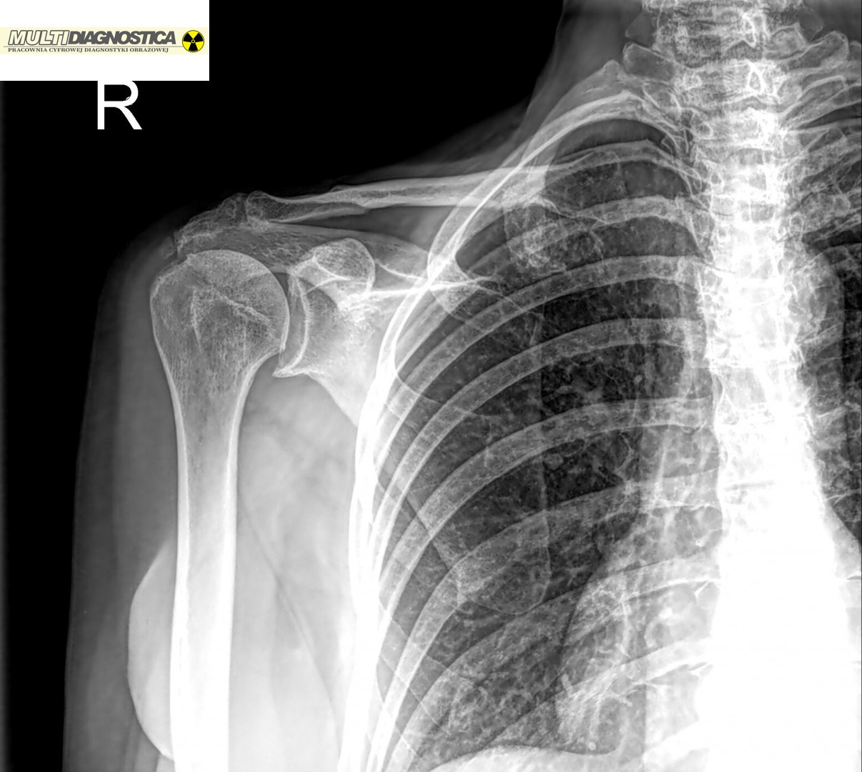 Rentgen RTG Kraków Pracownia Cyfrowej Diagnostyki Obrazowej