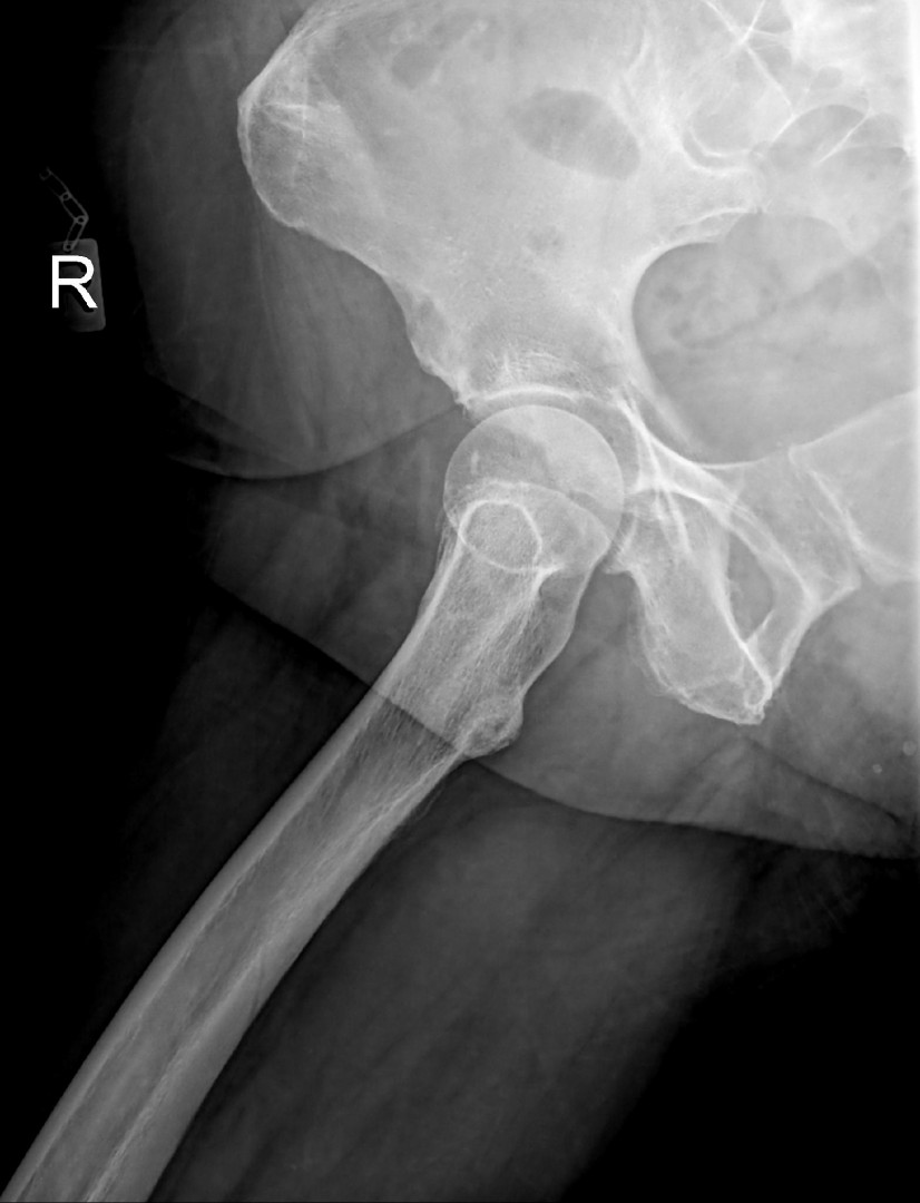 Rentgen RTG Kraków Pracownia Cyfrowej Diagnostyki Obrazowej