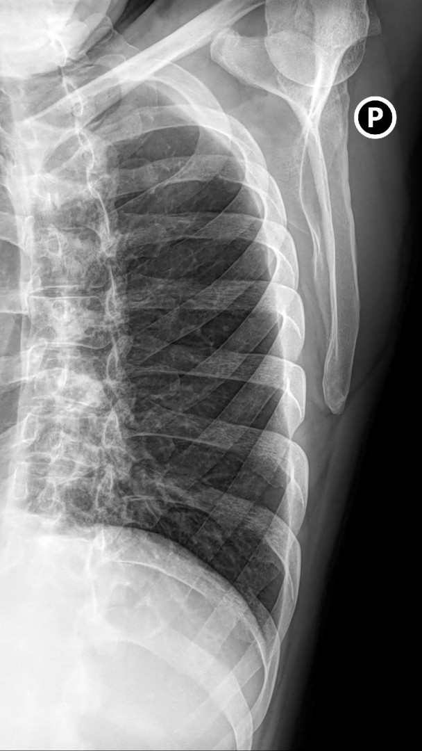 Rentgen RTG Kraków Pracownia Cyfrowej Diagnostyki Obrazowej