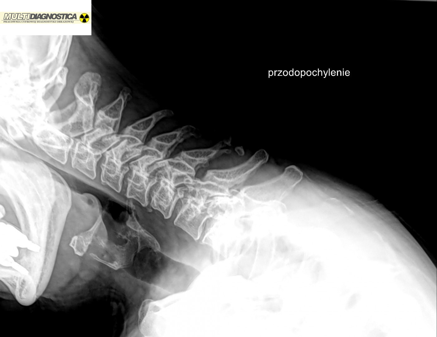 Rentgen RTG Kraków Pracownia Cyfrowej Diagnostyki Obrazowej