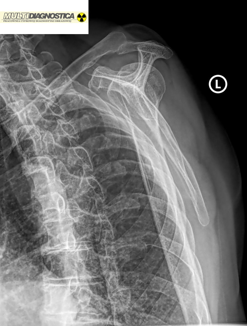 Rentgen RTG Kraków Pracownia Cyfrowej Diagnostyki Obrazowej