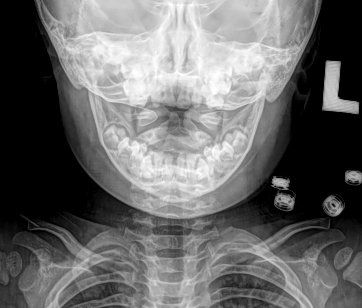 Rentgen RTG Kraków Pracownia Cyfrowej Diagnostyki Obrazowej