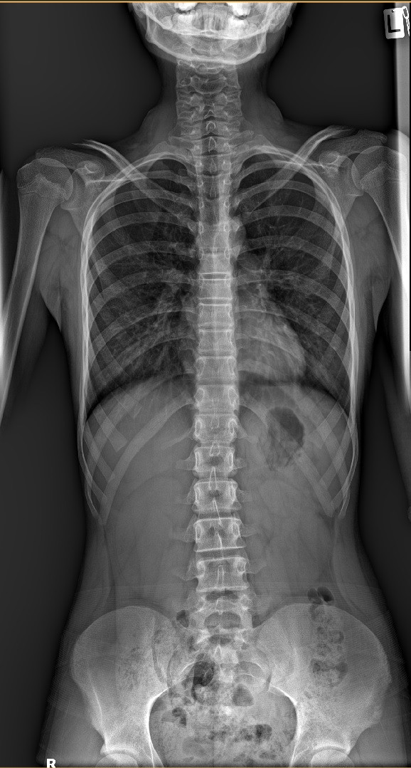 Rentgen RTG Kraków Pracownia Cyfrowej Diagnostyki Obrazowej