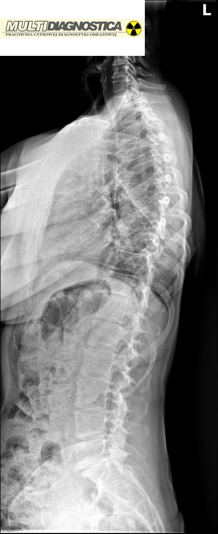 Rentgen RTG Kraków Pracownia Cyfrowej Diagnostyki Obrazowej