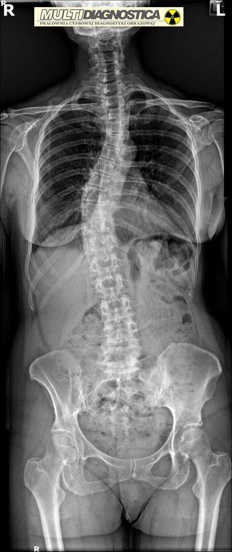 Rentgen RTG Kraków Pracownia Cyfrowej Diagnostyki Obrazowej