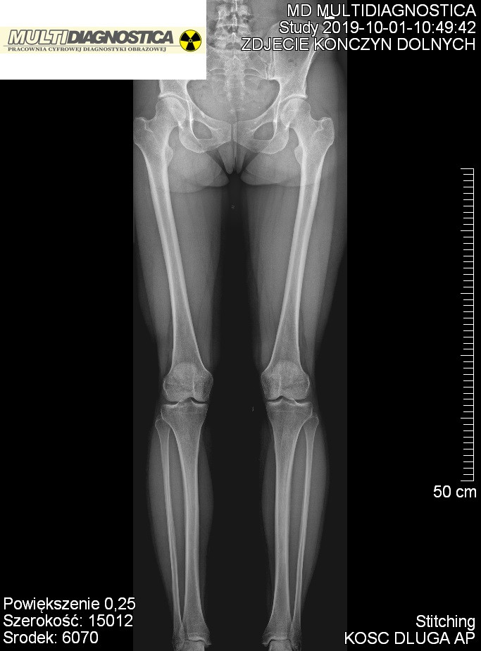 Rentgen RTG Kraków Pracownia Cyfrowej Diagnostyki Obrazowej