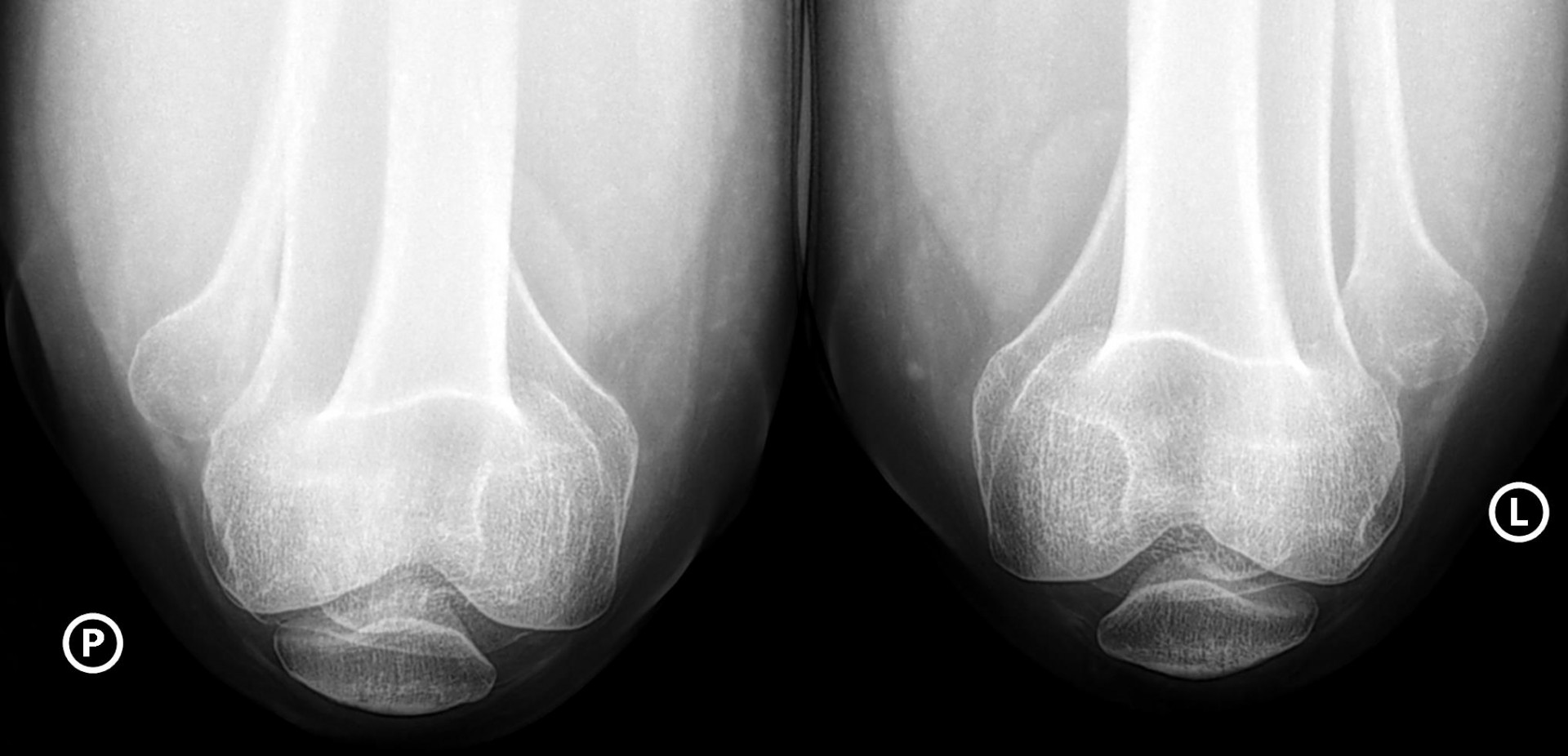 Rentgen RTG Kraków Pracownia Cyfrowej Diagnostyki Obrazowej